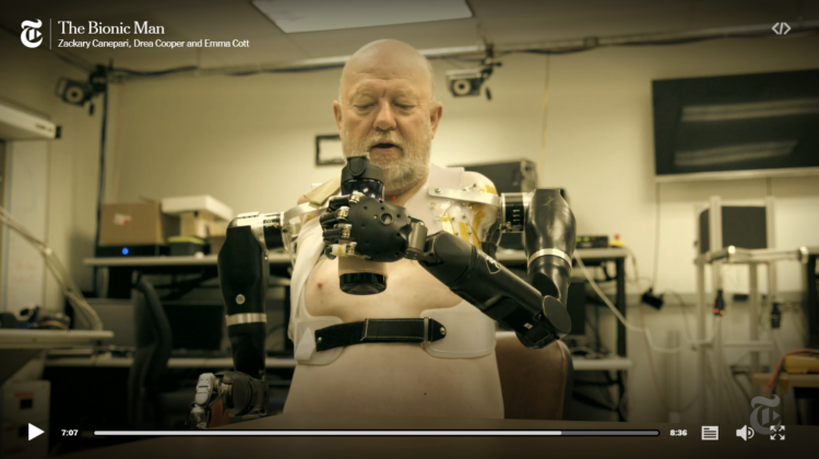 Prosthetic Limbs, Controlled by Thought | Desis: Senior Thesis Prosthetic Limbs, Controlled by Thought | Desis: Senior Thesis
